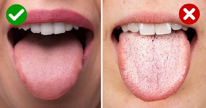 Diagnostika podle jazyka: Co vypovídá jazyk o vašem zdravotním stavu ...